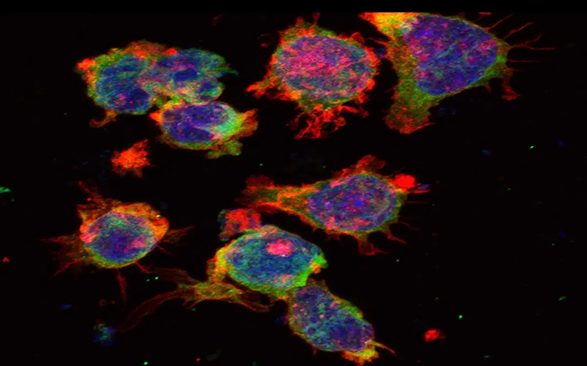 Descubren el "talón de Aquiles" del cáncer: una nueva vía para atacar ...