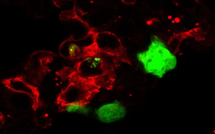 Crean una vacuna "universal" contra el cáncer que destruye los tumores ...