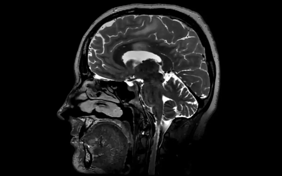 La ciencia descubre que el cerebro humano puede estar en modo ...